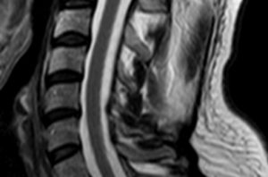 MRI – PROCEDURES OFFERED – CareFirst